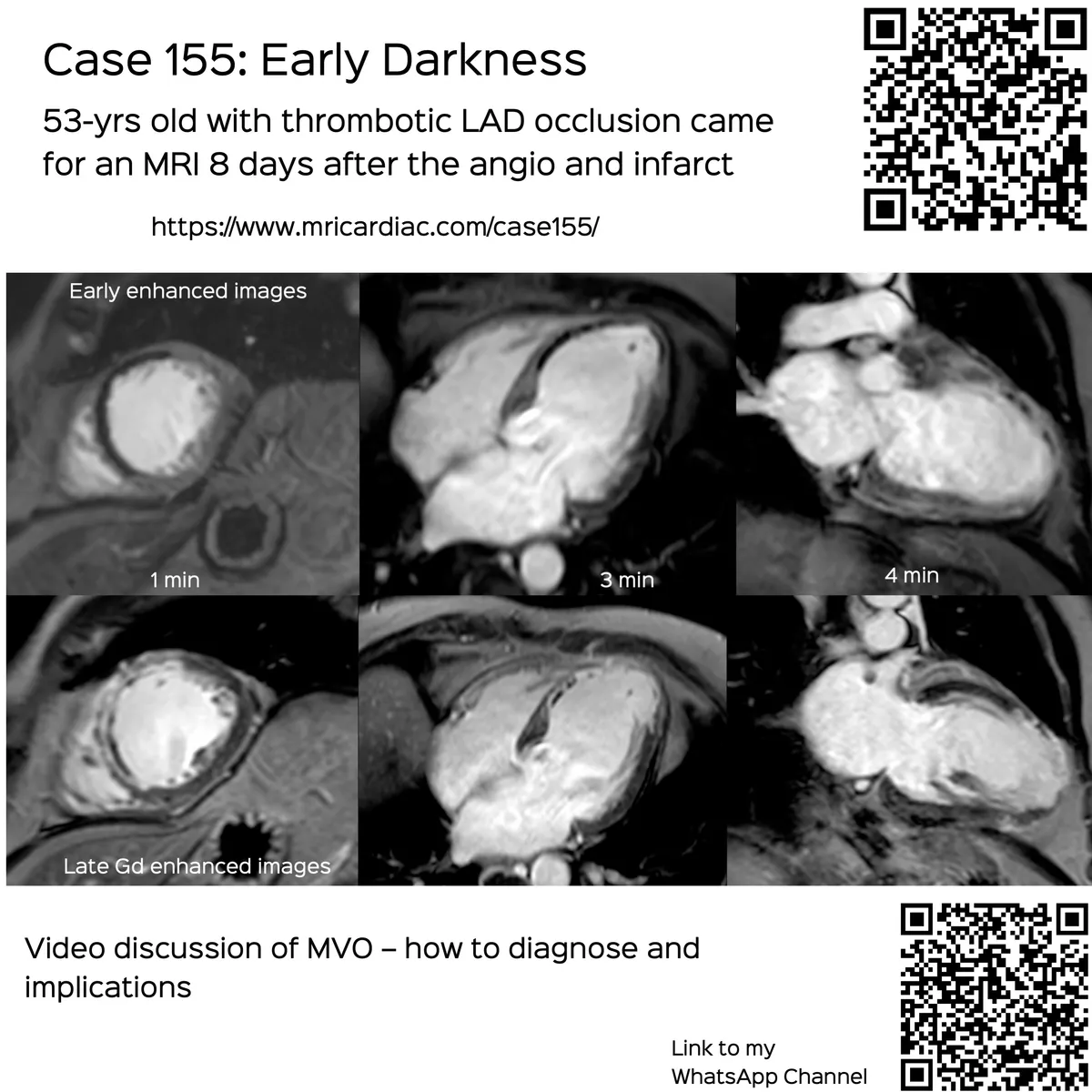 Case based learning of Cardiac MRI