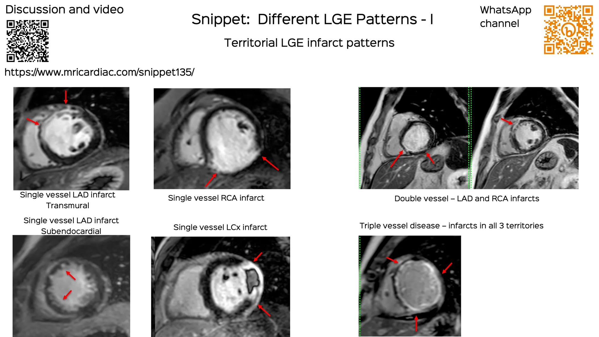 Case based learning of Cardiac MRI