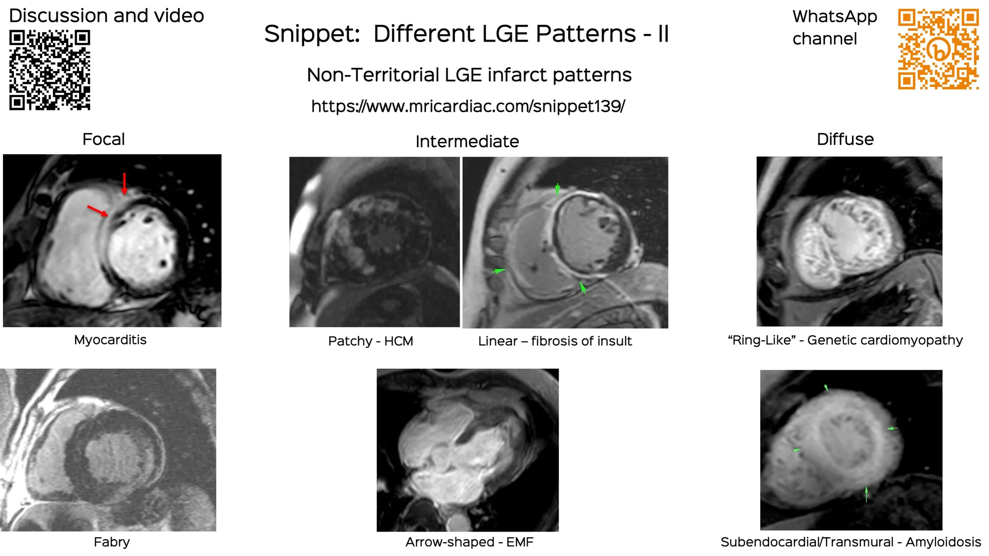 Case based learning of Cardiac MRI