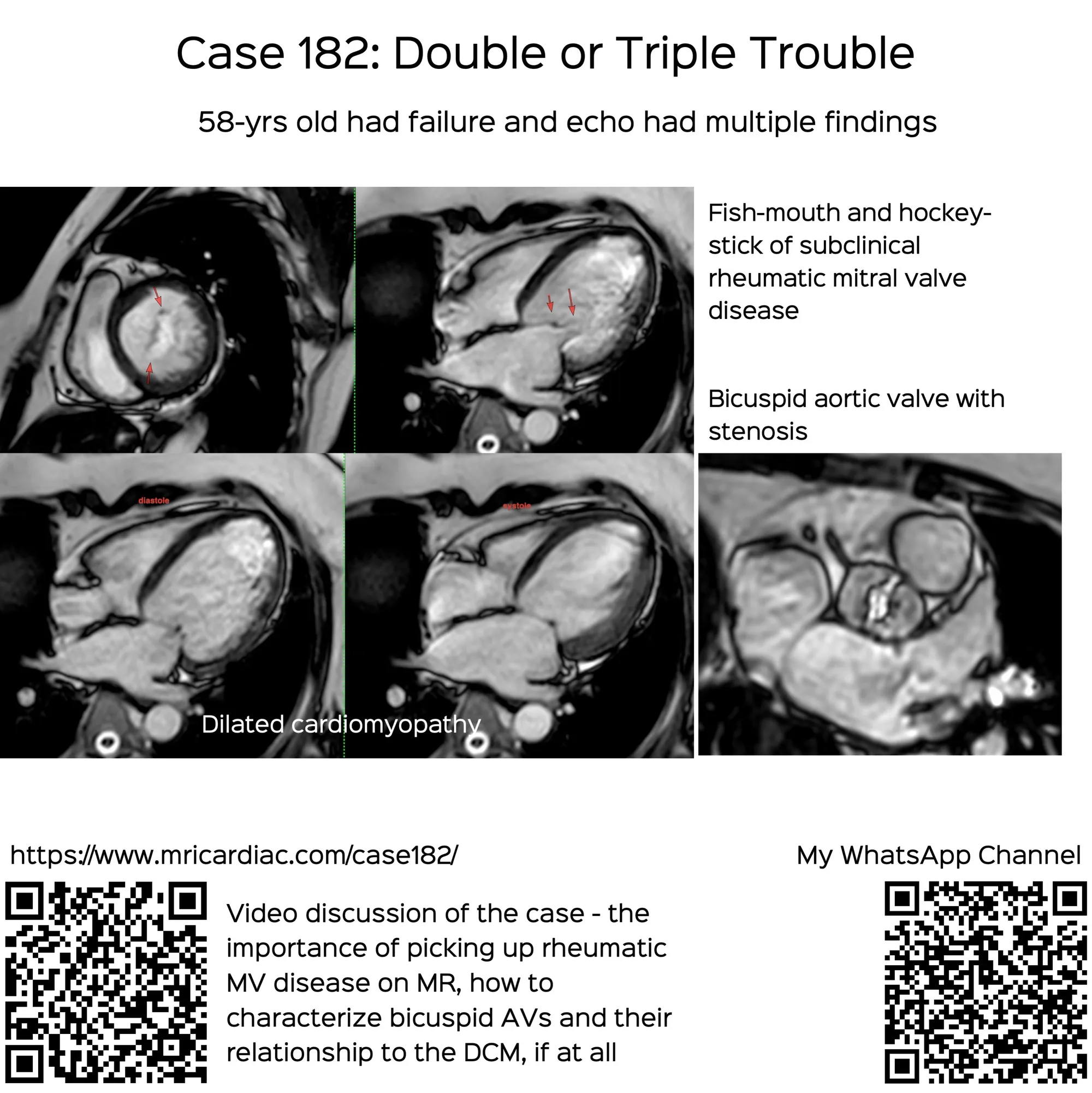 Case based learning of Cardiac MRI