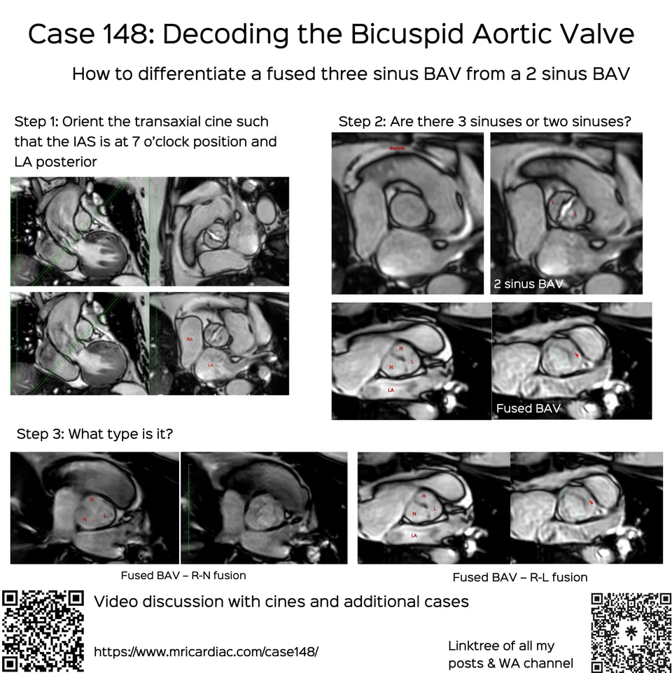 Case based learning of Cardiac MRI